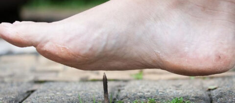 Understanding the Different Types of Wounds and Their Treatments ...